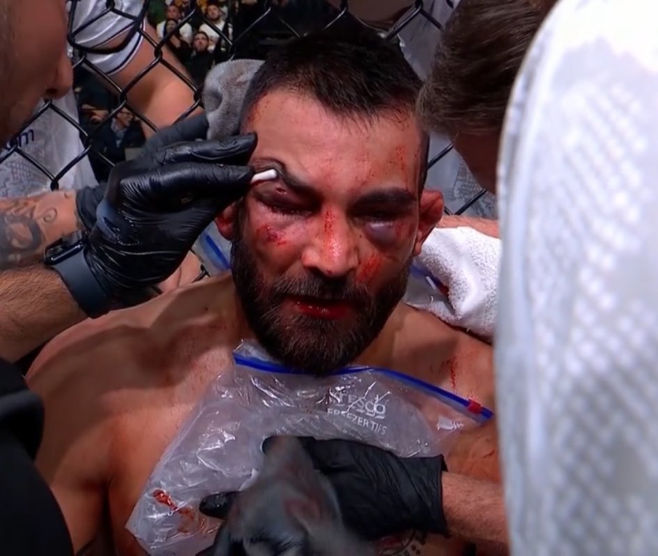 Les combattants de l'UFC réagissent aux graves blessures de Benoit ...